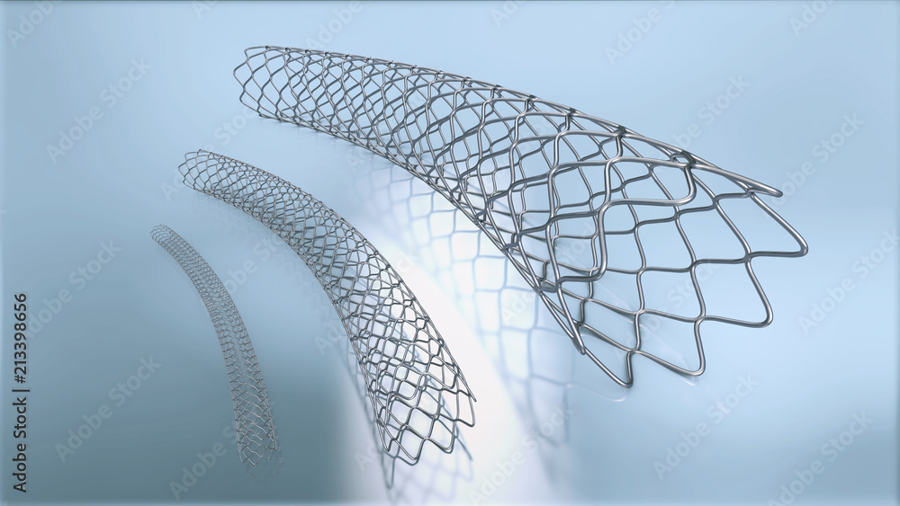 3d illustration of three metal stents for implantation and supporting ...
