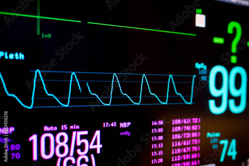 Normal heart function on pulse oximeter pleth graph bar Stock Photo ...