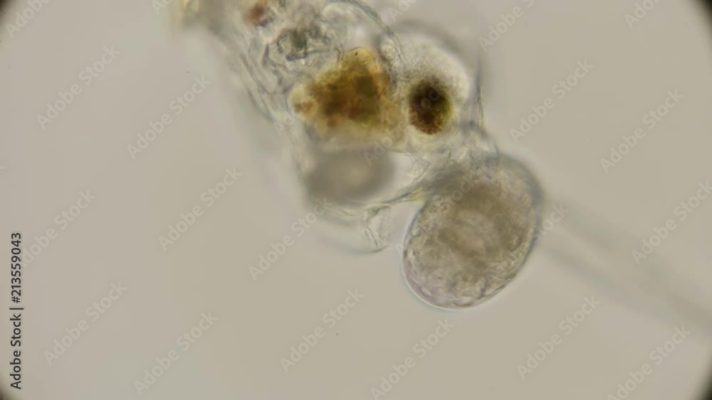 the rotifer Brachionus plicatilis with eggs, you can see all the ...