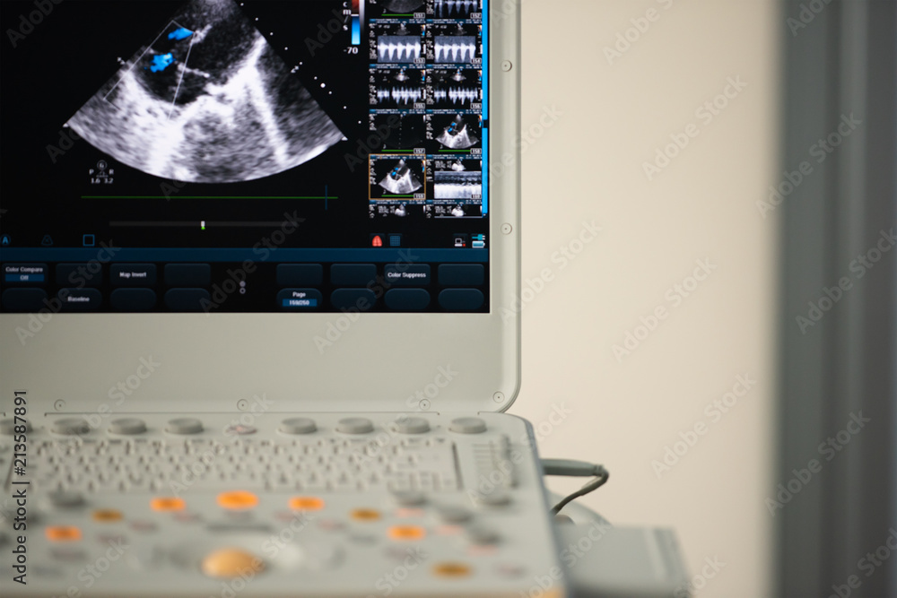 Screen of an ultrasound scanner with the image of tricuspid ...