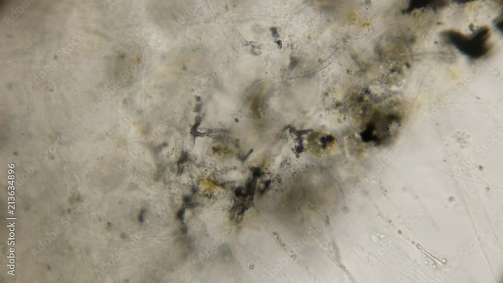 Video „in the Dead fish bred colonies Tetrahymena, water fungi mold ...