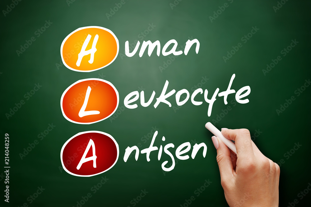 HLA - Human Leukocyte Antigen acronym, health concept on blackboard ...
