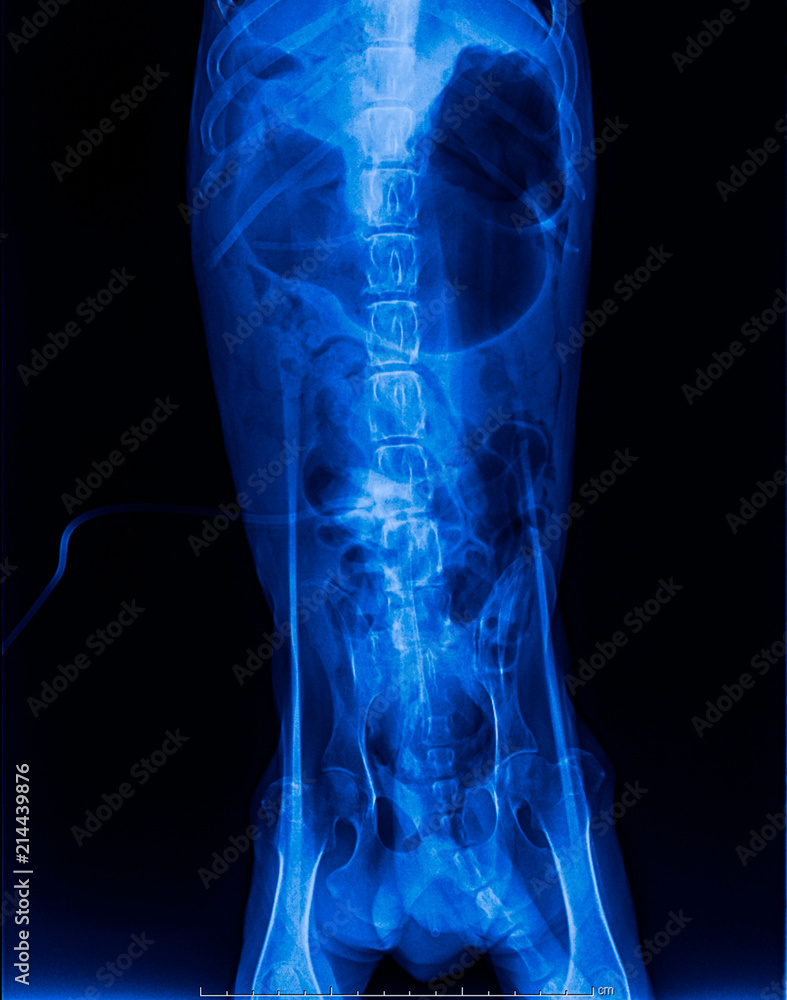 x-ray film of dog anterior view closed up in thorax standard and ...