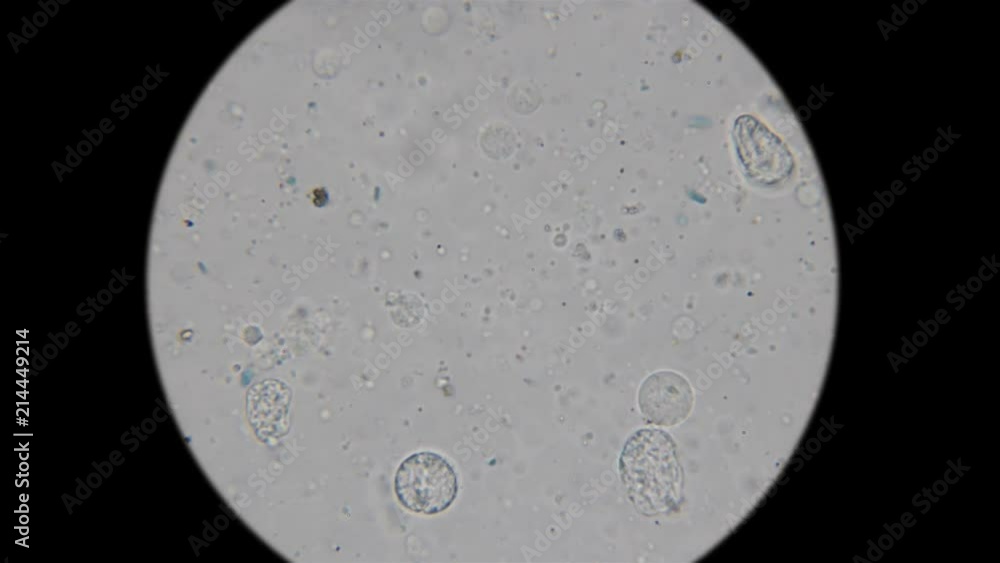 the hemolymph of the so-called blue blood of a crayfish under a ...