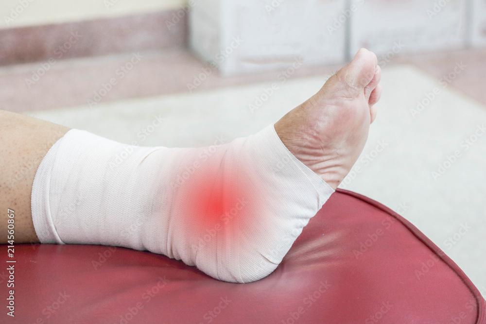 Foot pain, female heel intertwined with a cloth with red spots on chair ...