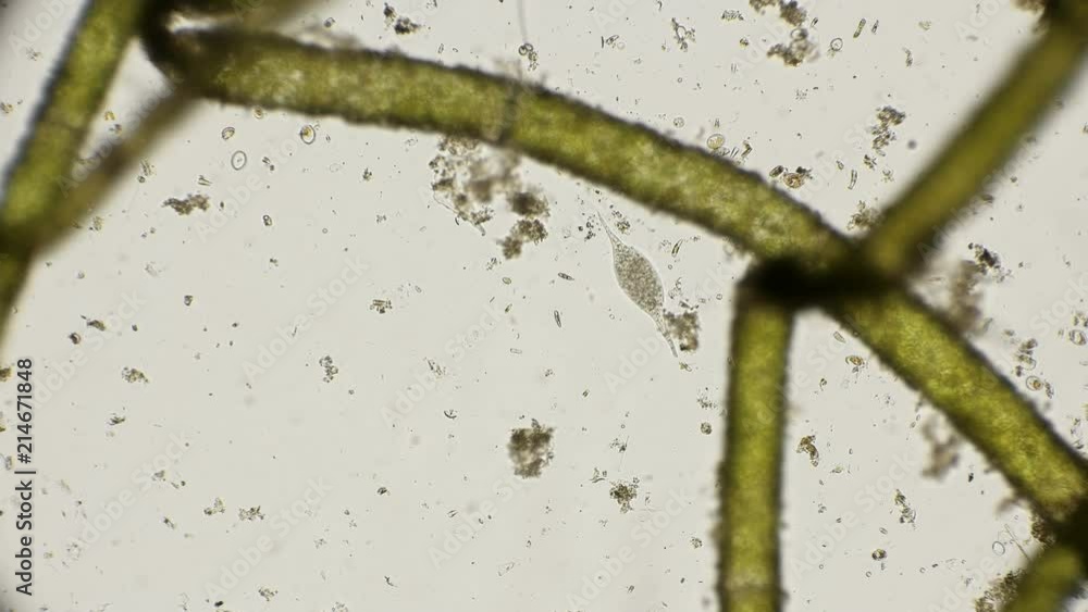 Litonotus infusoria under a microscope Stock Video | Adobe Stock