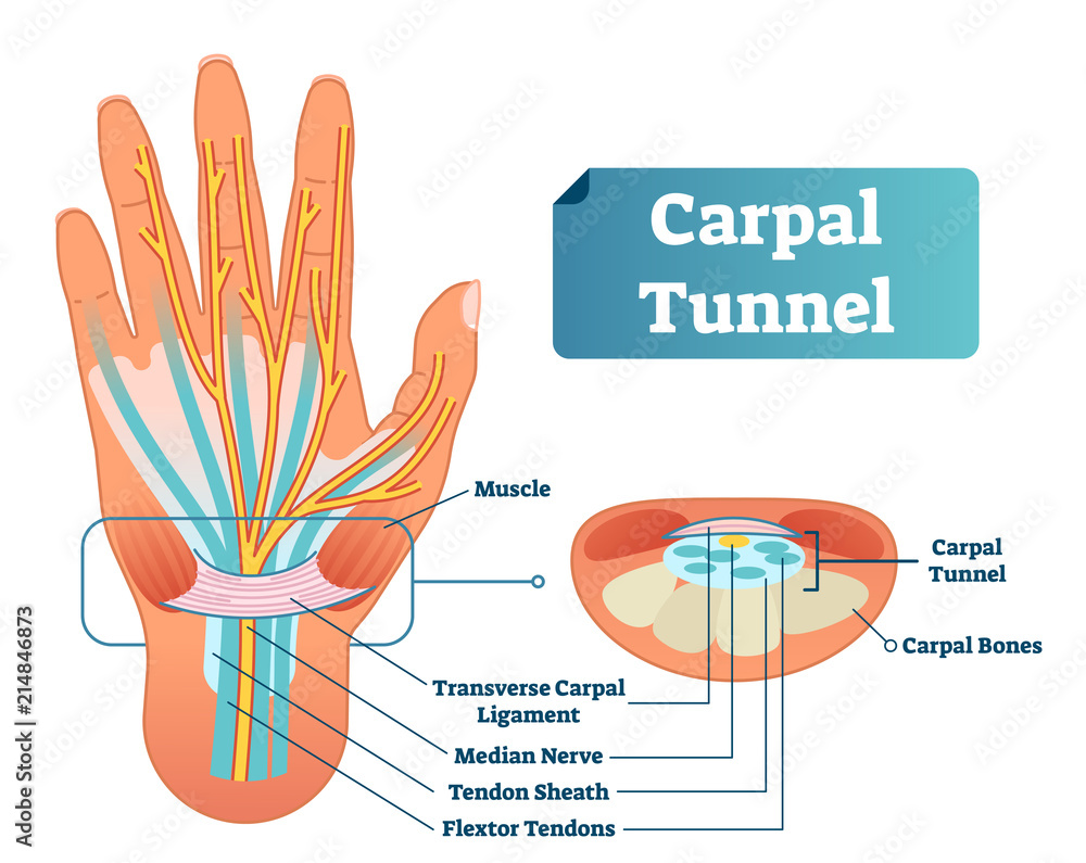 Carpal tunnel vector illustration scheme. Medical labeled diagram ...
