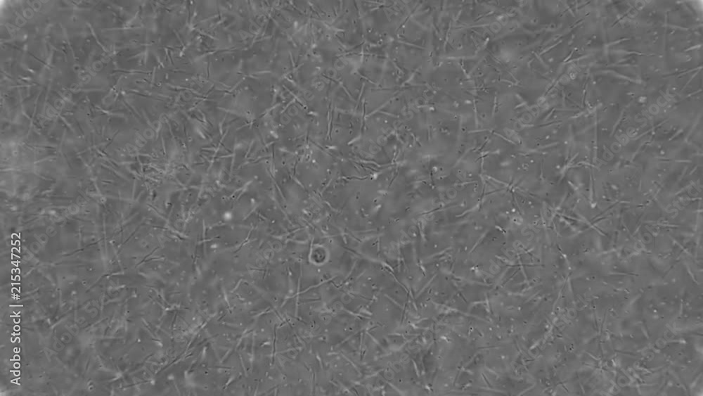 colony of spirochete, rod-shaped bacteria and other bacteria living in ...