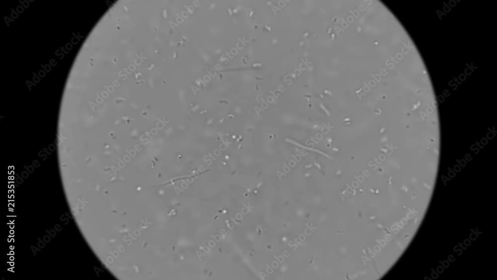 colony of bacteria living in dirty rotten water: Vibrio, spirilla ...