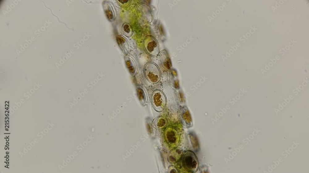 diatoms Cocconeis fixed on filamentous algae, under a microscope Stock ...