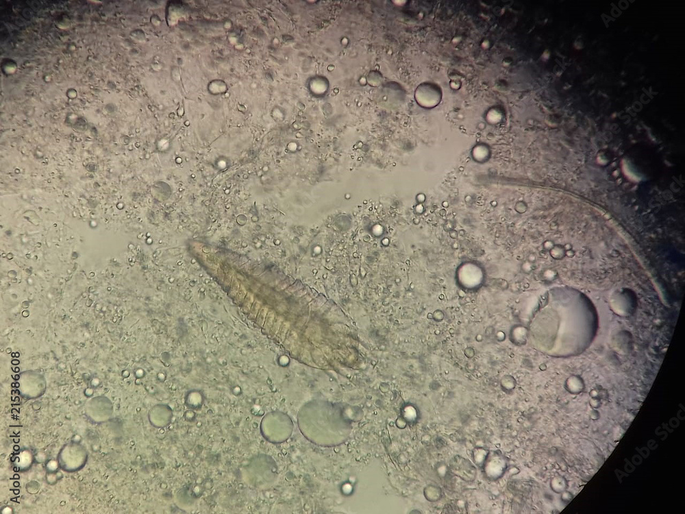 Demodex parasite under skin in dog or people take photo from microscope ...