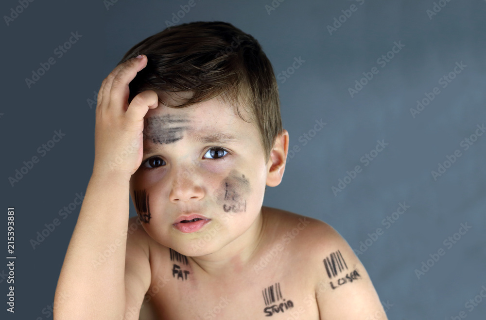 sad child who suffer bullying with bar code and insults in his face ...