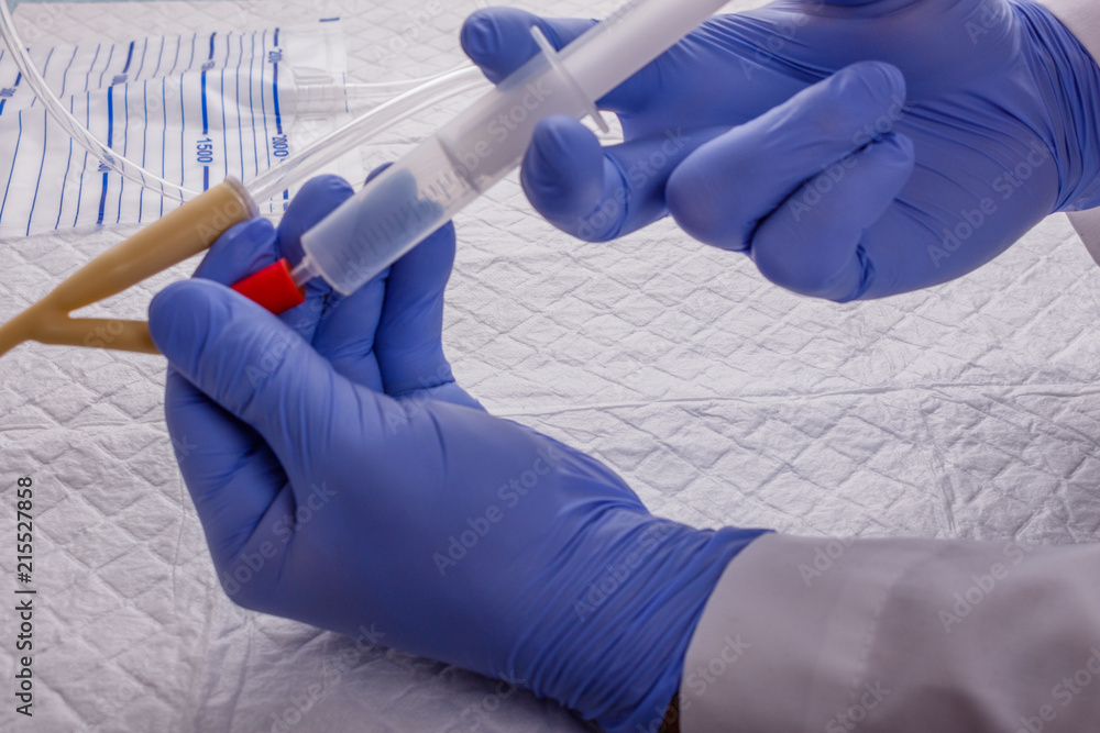 Nurse inflates urinary catheter bulb with leg drainage bag on sterile ...