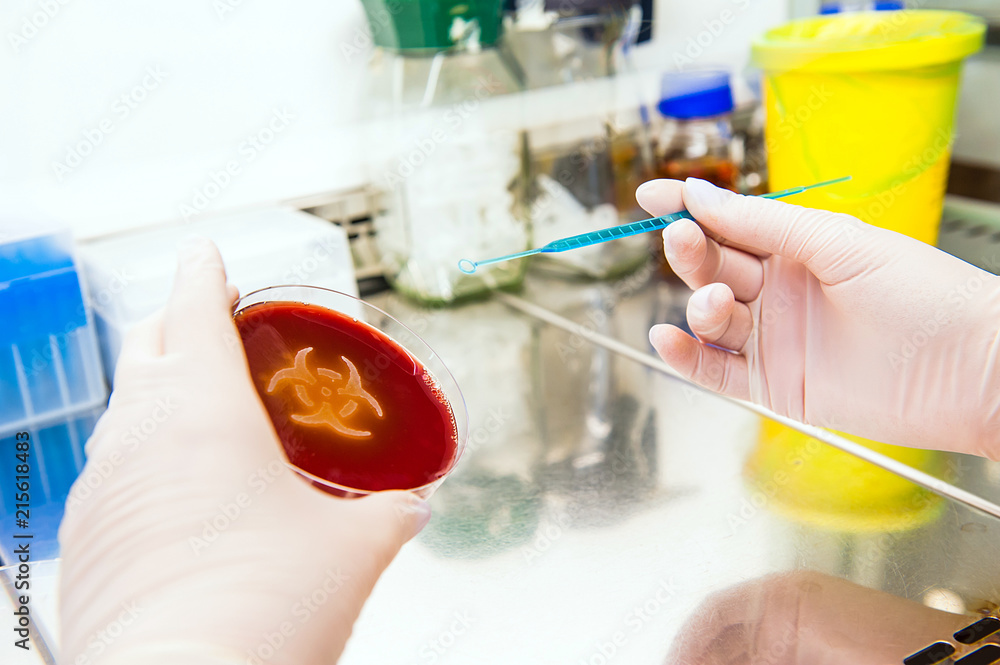 Microbiology biohazard - bacteria culture Stock Photo | Adobe Stock