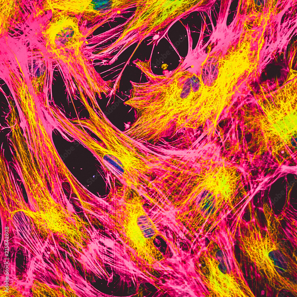 Poster Confocal microscopy of fibroblast cells – Wall Art | UkPosters