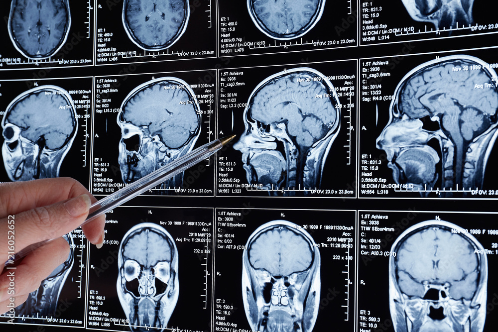 Magnetic resonance scan of the brain. MRI head scan Stock Photo | Adobe ...
