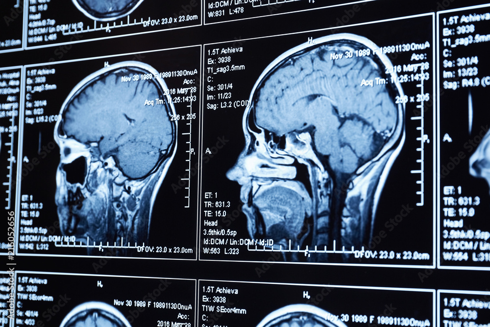 Magnetic resonance scan of the brain. MRI head scan Stock Photo | Adobe ...