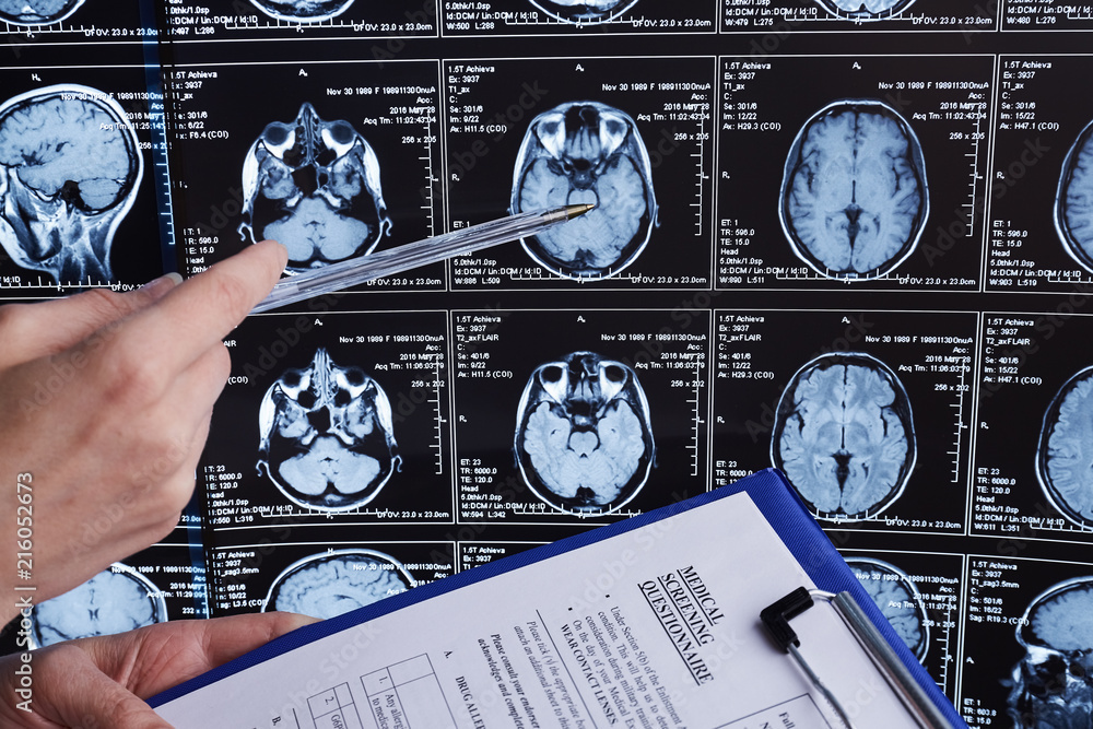 Magnetic resonance scan of the brain. MRI head scan Stock Photo | Adobe ...