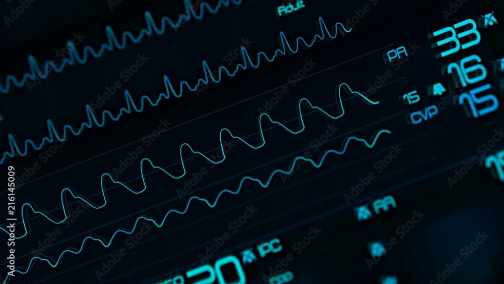 Multi-parameter patient monitor screen / Medical blue screen interface ...