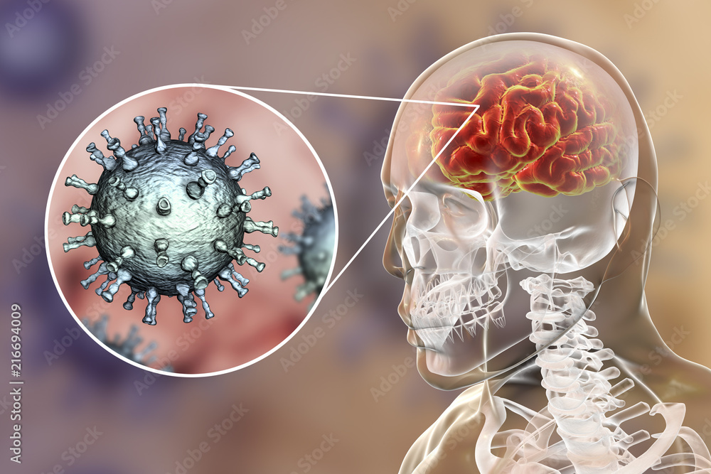 Varicella zoster virus VZV encephalitis, medical concept, 3D ...