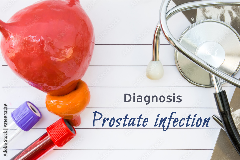 Diagnosis of Prostate infection. Medical concept picture of prostate ...