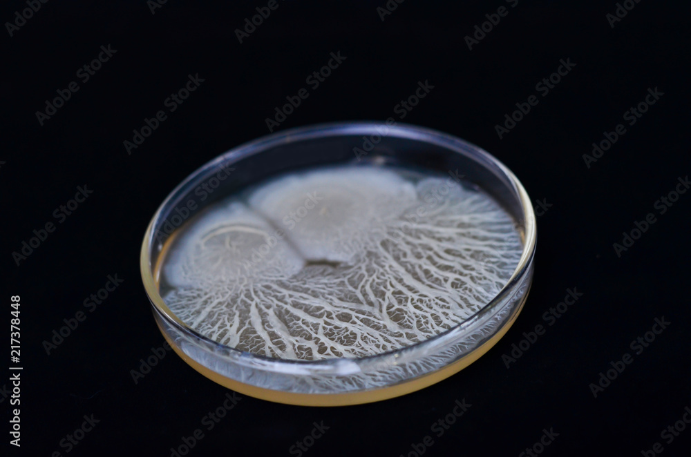 Beautiful bacterial colonies of Bacillus sp growing on agar plate Stock ...