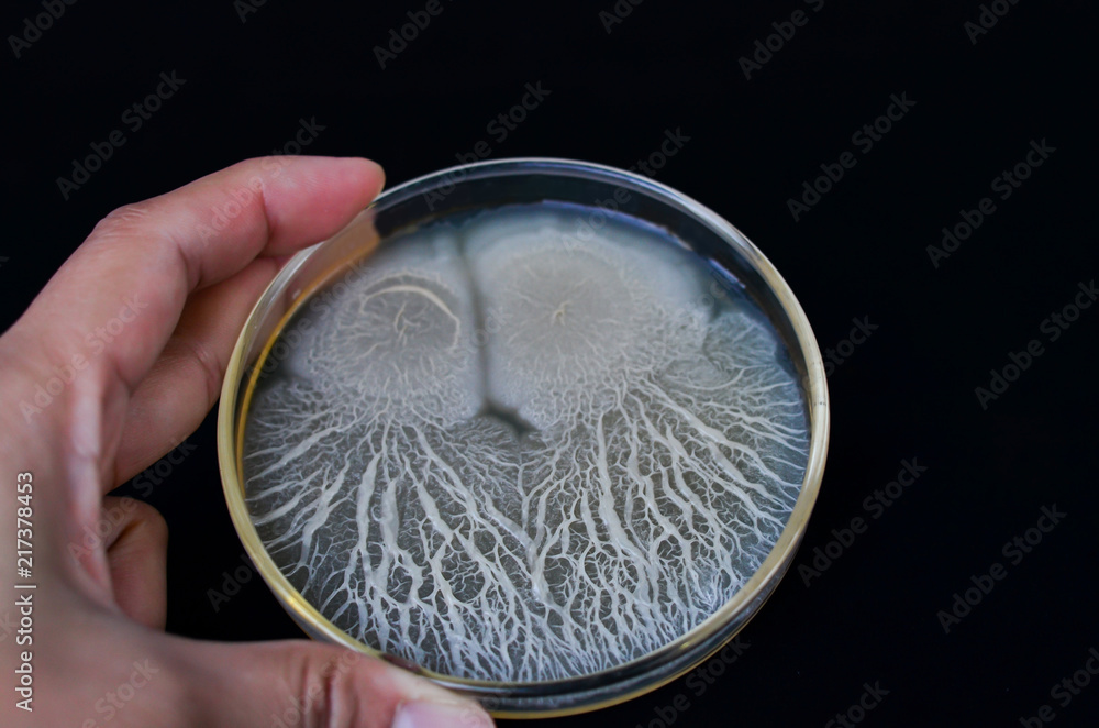 Beautiful bacterial colonies of Bacillus sp growing on agar plate Stock ...