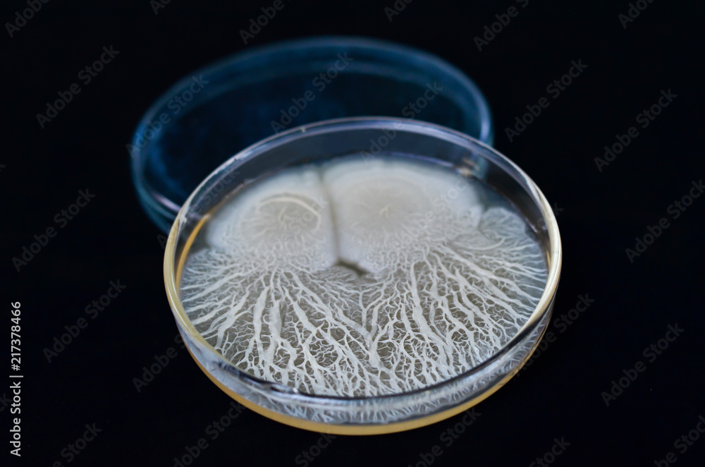 Beautiful bacterial colonies of Bacillus sp growing on agar plate Stock ...