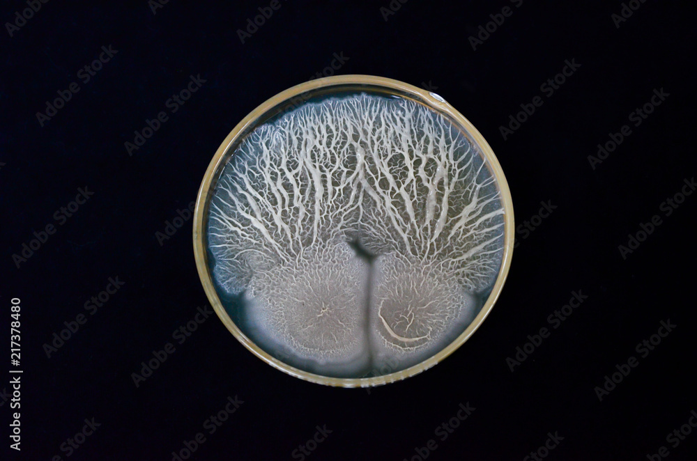 Beautiful bacterial colonies of Bacillus sp growing on agar plate Stock ...