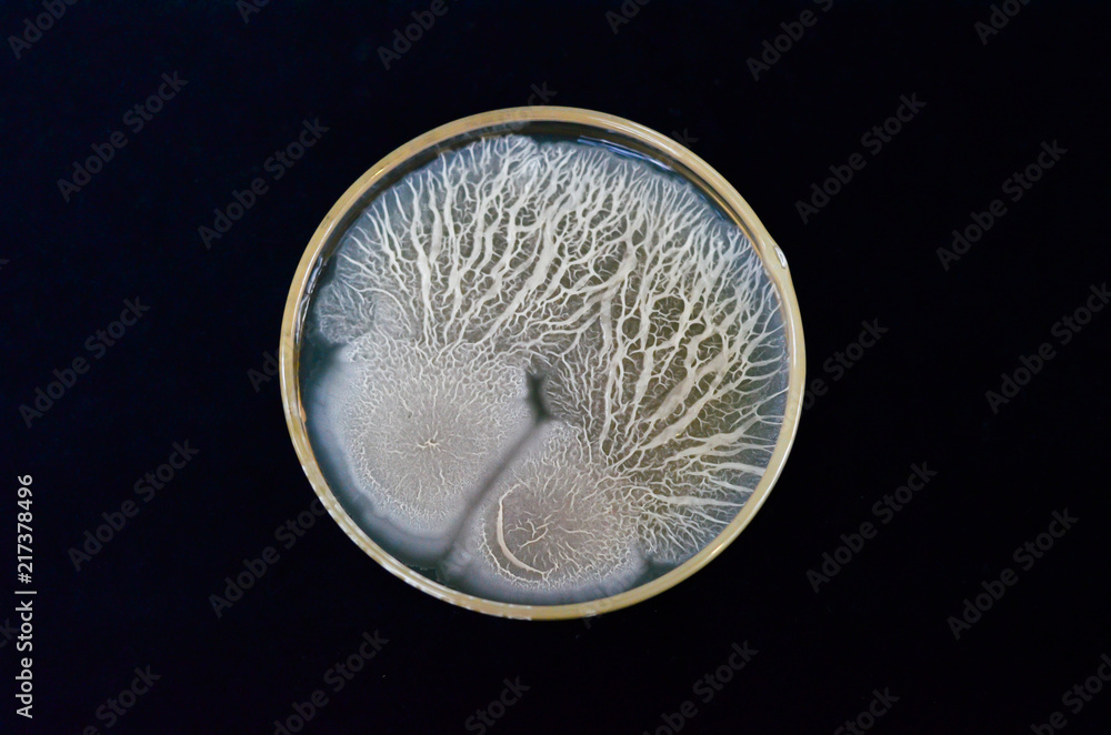 Beautiful bacterial colonies of Bacillus sp growing on agar plate Stock ...