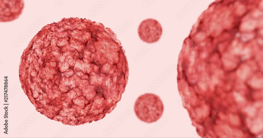 4k Cancer Tumor expanding cancer growing cells lymphoma carcinoma ...