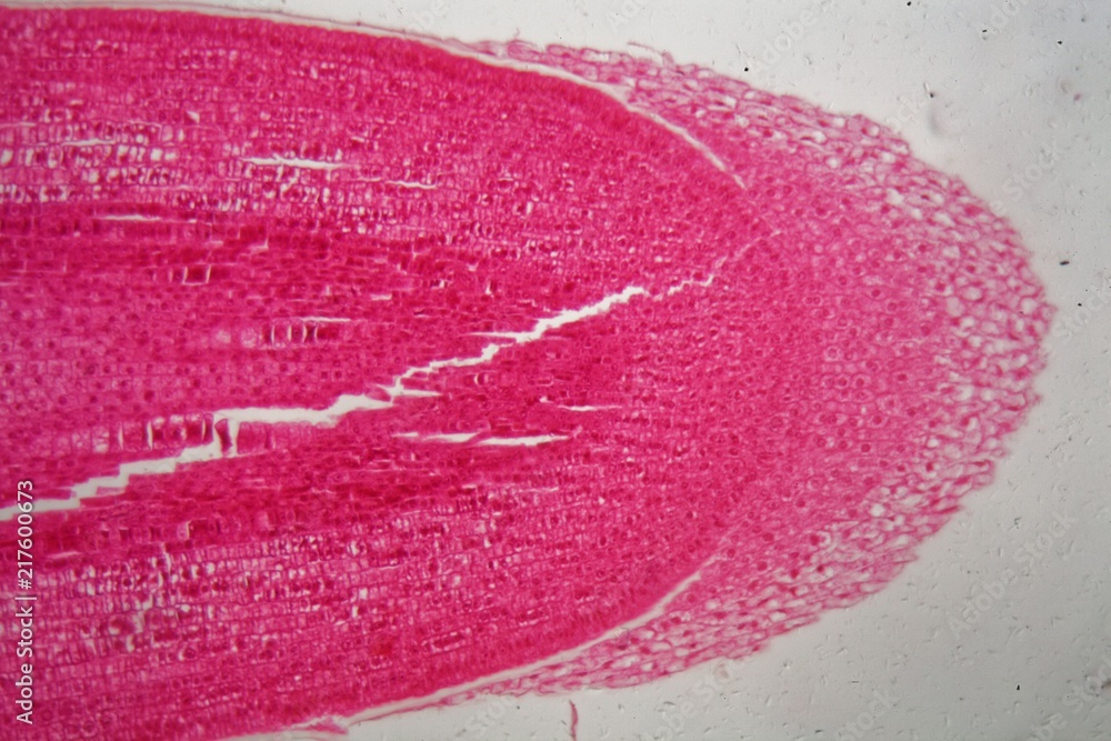 Longitudinal section through cells of a root from a maize plant under ...