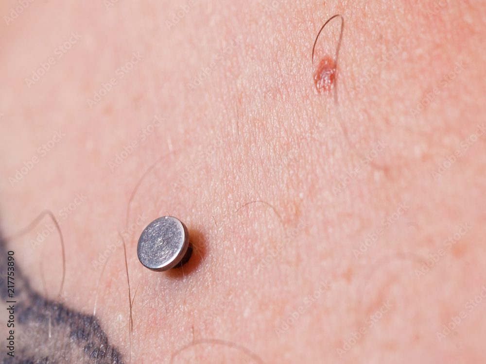 Sternum, cleavage, microdermal, surface piercing on collarbones. Stock ...