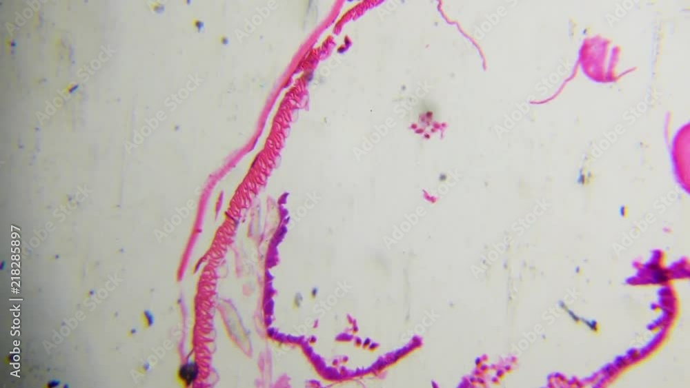 Ascaris female, cross section, magnified 100 times through a microscope ...