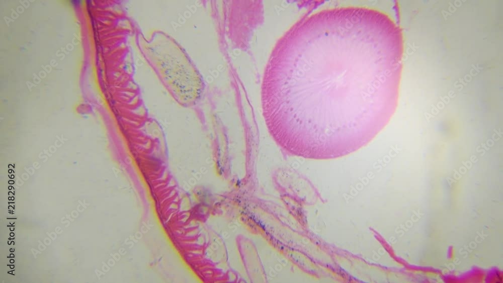 Ascaris female, cross section, magnified 100 times through a microscope ...