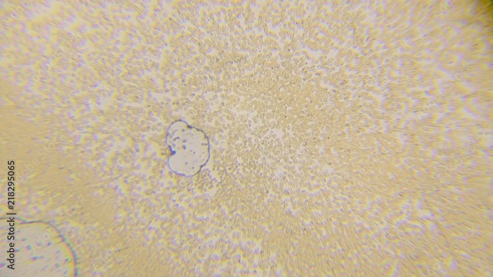 Human red blood cells, through microscope, moving, magnified 100 times ...