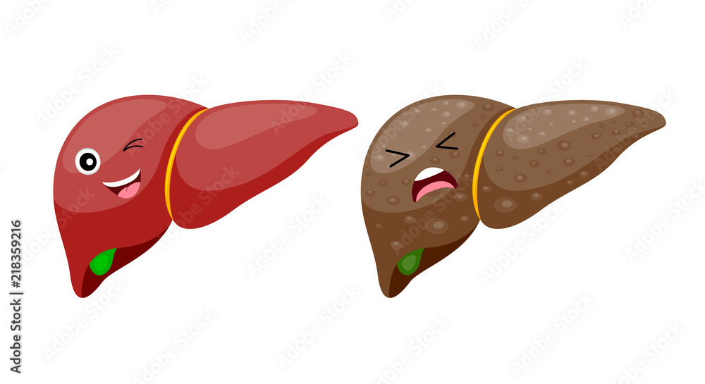 Comparison of healthy liver and cirrhosis. Liver Disease. Vector ...