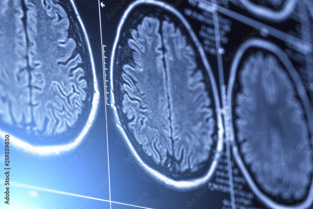 Abstract image with blue light effect effect of MRI or magnetic ...