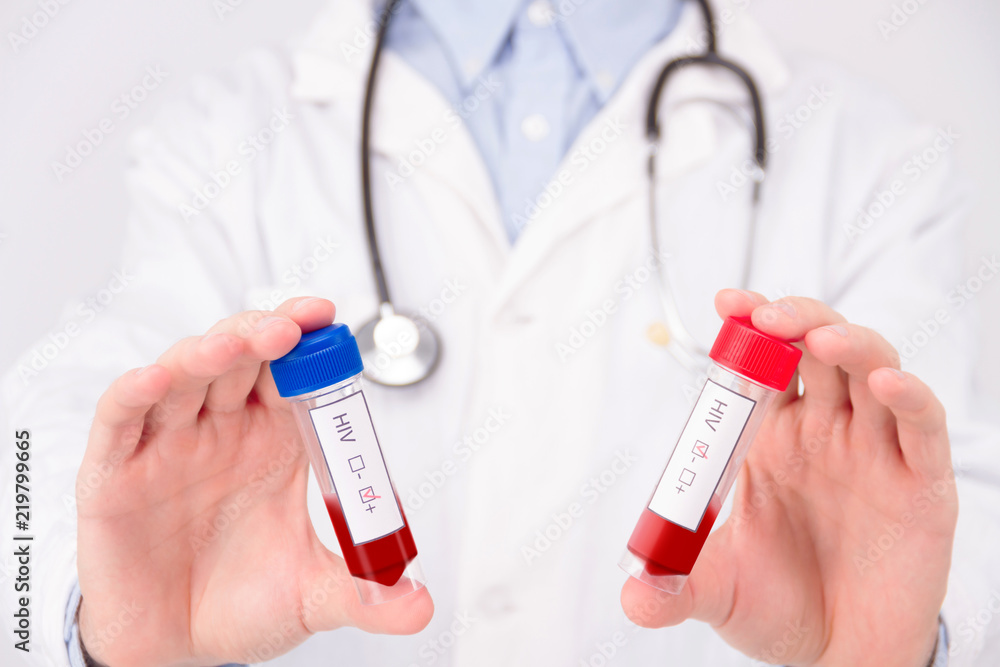 AIDS / HIV disease concept. Doctor wearing white coat blue rubber ...