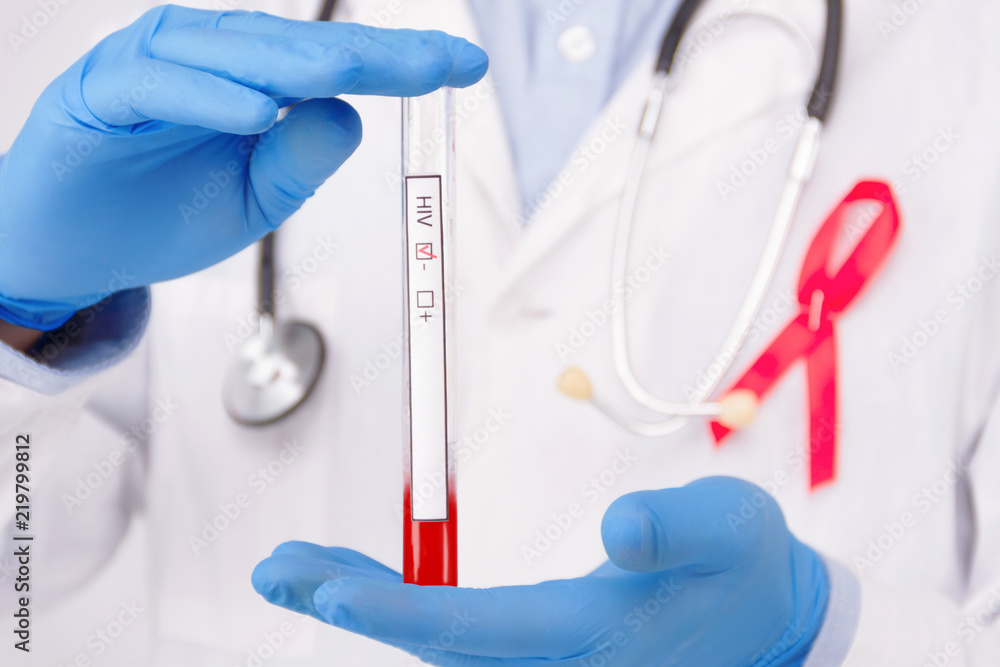 AIDS / HIV disease concept. Doctor wearing white coat and blue rubber ...