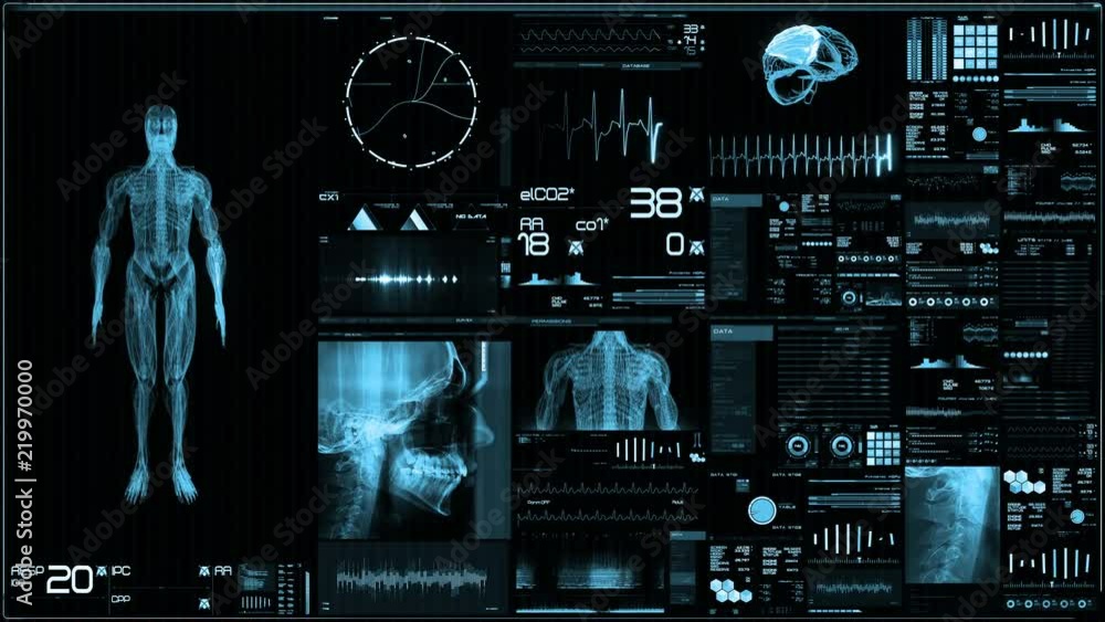 Blue futuristic patient monitor screen in perspective / Medical screen ...