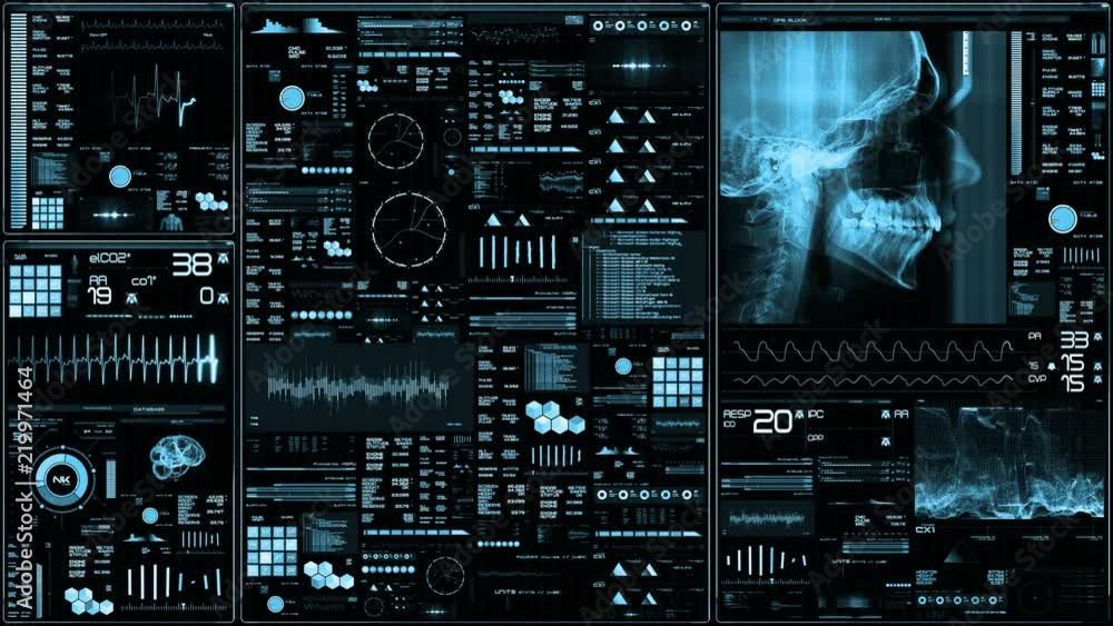 Blue futuristic patient monitor screen in perspective / Medical screen ...