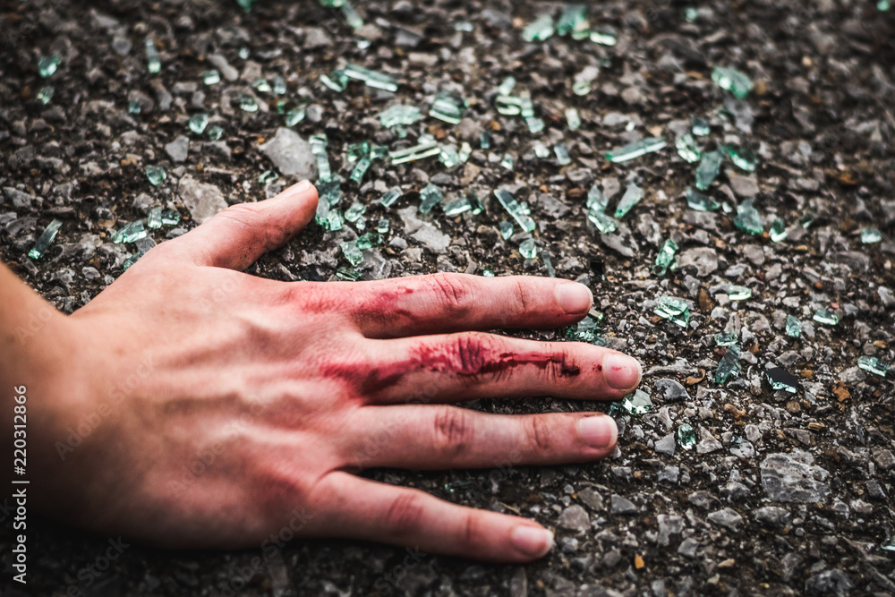 Injured Hand Braced on Asphalt Pavement Stock Photo | Adobe Stock