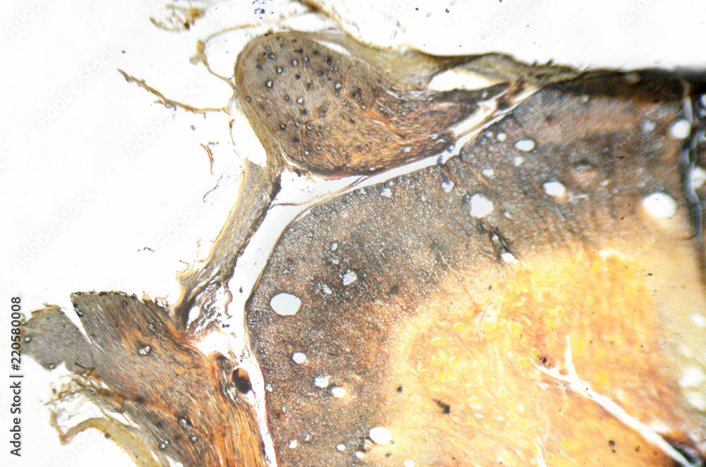 Microscope photography. Spinal cord, cross section. Stock Photo | Adobe ...