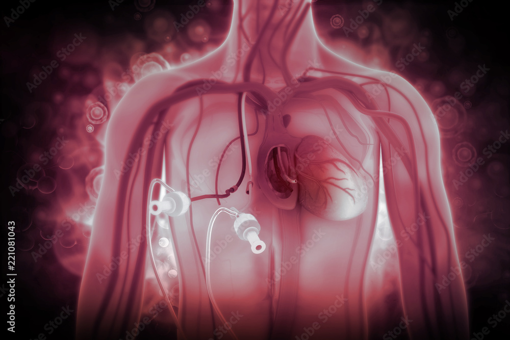 Dialysis process 3d illustration Stock Illustration | Adobe Stock