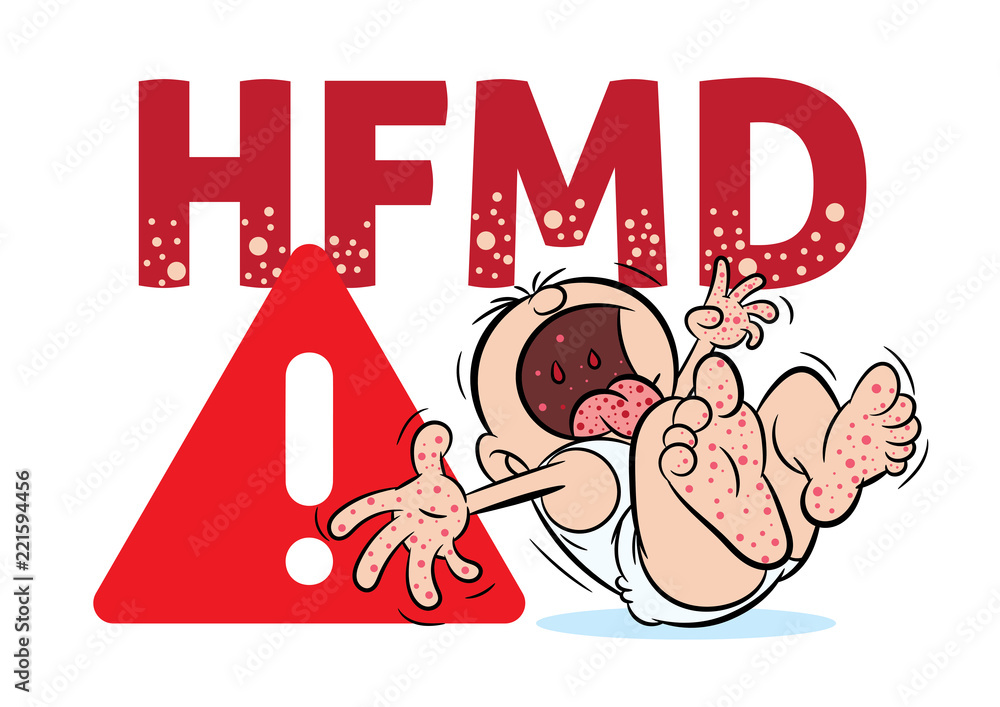 Crying baby with hand, foot and mouth disease or HFMD illustration ...