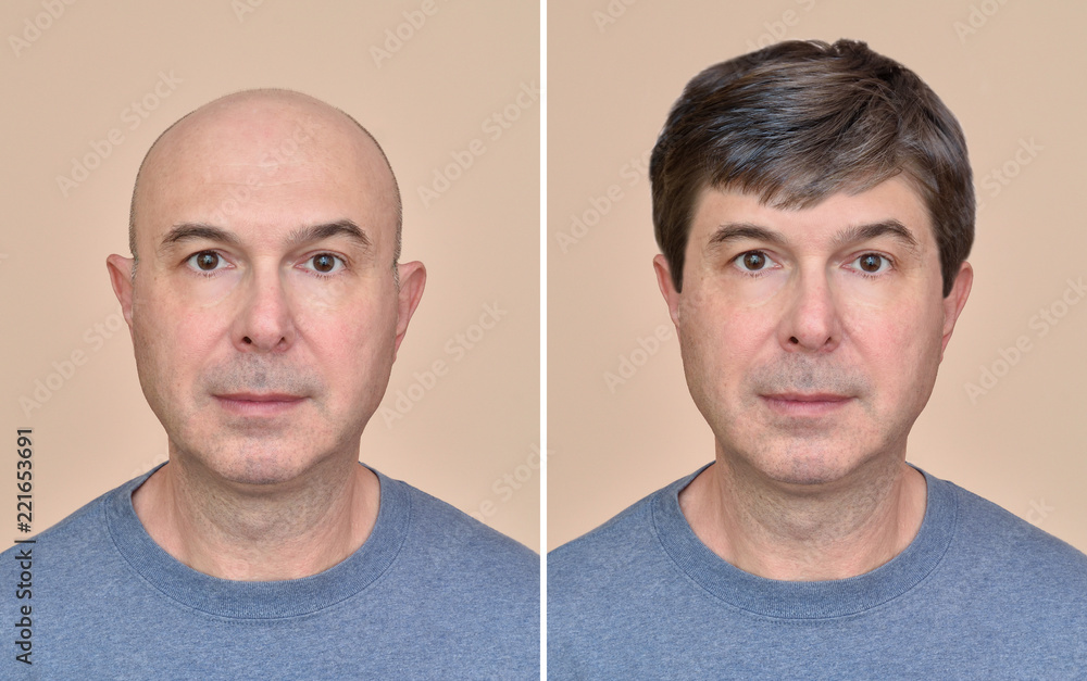 Two portraits of a same middle aged bald man before and after wearing ...