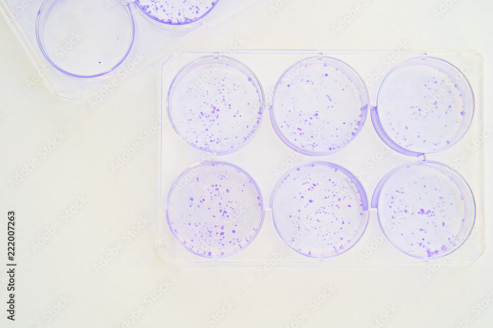 Colony formation of cancer cell lines are stained with crystal violet ...