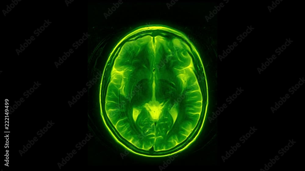 Computed medical tomography MRI upscaled scan of healthy young female ...