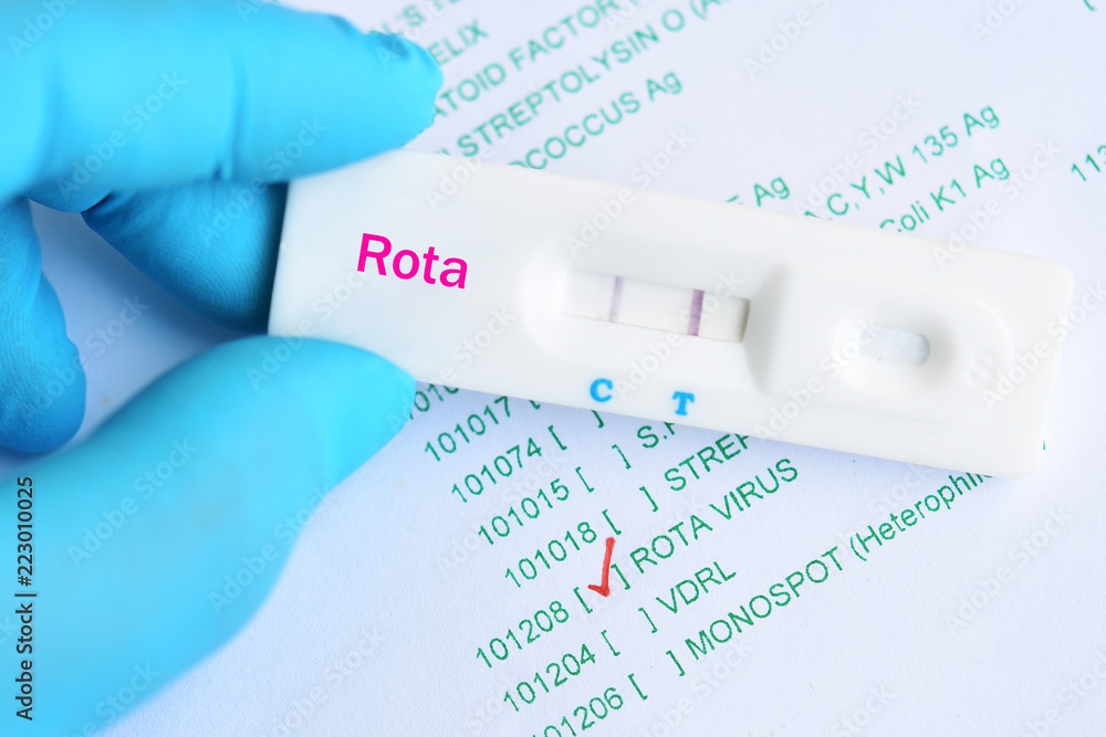 Rotavirus positive test result by using rapid test cassette, diagnosis ...